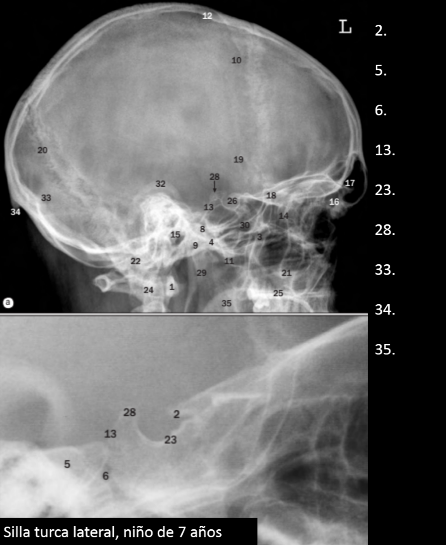 Juegos de Ciencias | Juego de Cráneo, proyección lateral (parte 2) RX ...