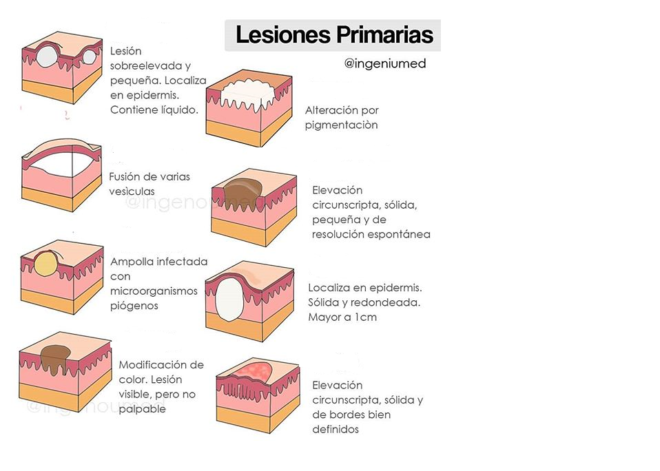 Juegos de Ciencias | Juego de Lesiones primarias de la piel | Cerebriti