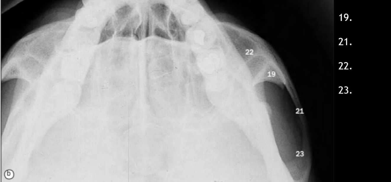 Juegos de Ciencias | Juego de Arco cigomático, proyección ...