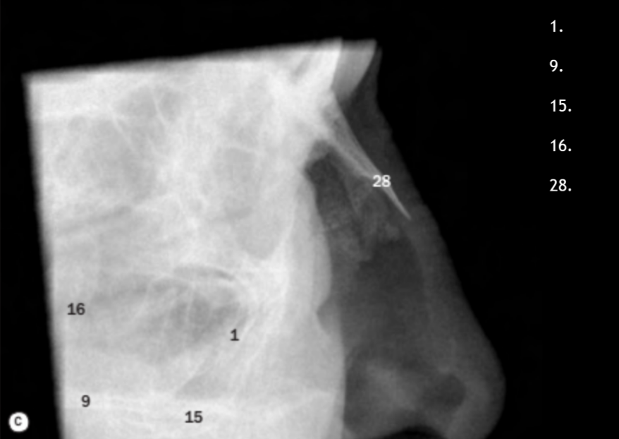 Juegos de Ciencias | Juego de Huesos nasales, proyección lateral Rx ...